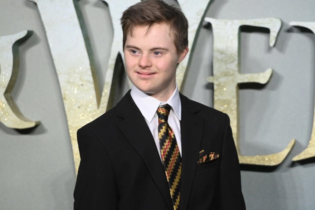Primer actor con síndrome de Down participará en "Peter Pan y Wendy ...